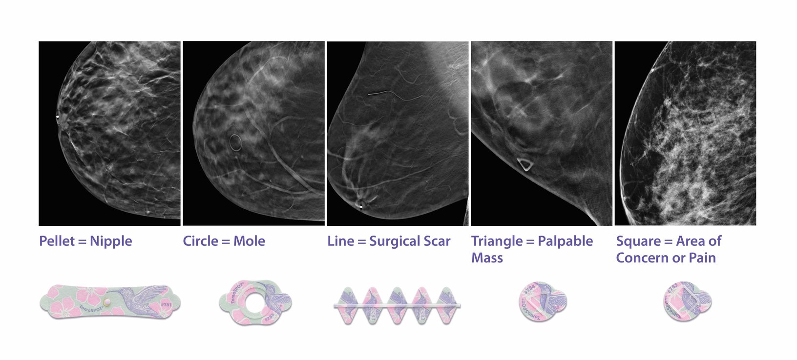 How Small Details in Mammography Build Patient Trust and Improve ...
