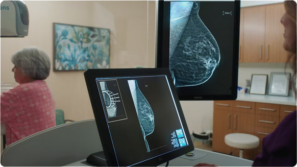 Videos Explain Use of Mammography Skin Markers to Patients and Staff