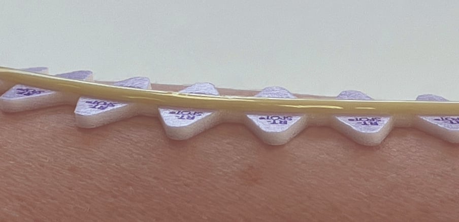 Getting It Right the First Time: How Elevated Skin Markers Are Changing ...