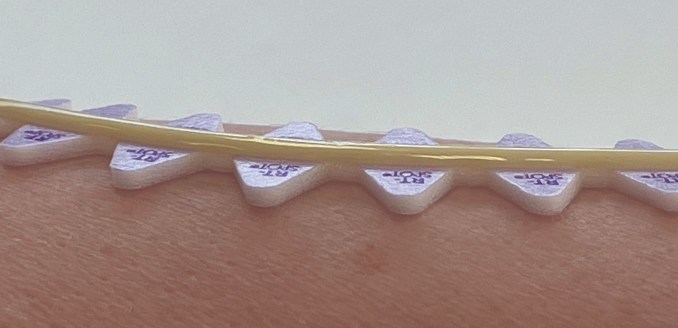 Getting It Right the First Time: How Elevated Skin Markers Are Changing ...