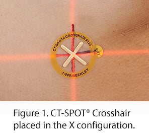 Finding the Zero Slice in CT Treatment Planning