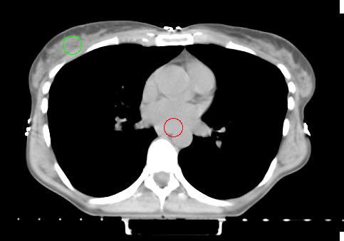 Our Best Practice with Crosshair Skin Markers for Three Point Set-Ups ...