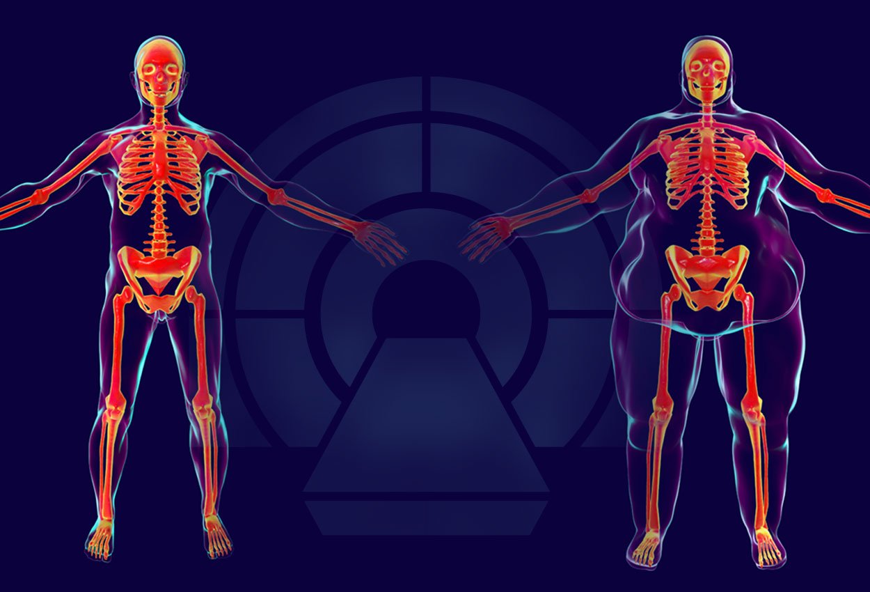 Challenges Of Imaging Obese Patients Challenges Of Imaging Obese Patients