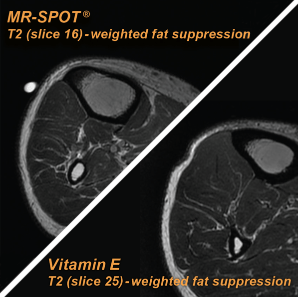 Patient Callbacks in MRI Due to Miscommunication Largely Preventable